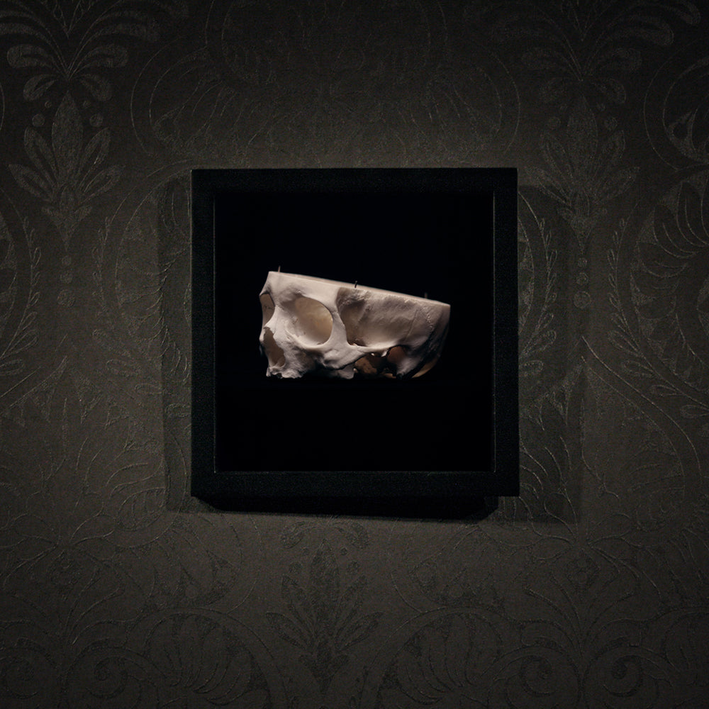 Cut skull, real human skull photography - Square framed poster – TORVENIUS