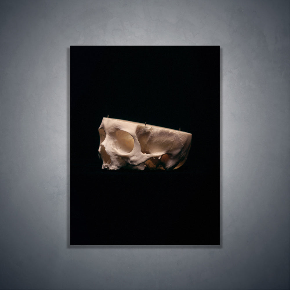 Cut skull, real human skull photography - Art print – TORVENIUS